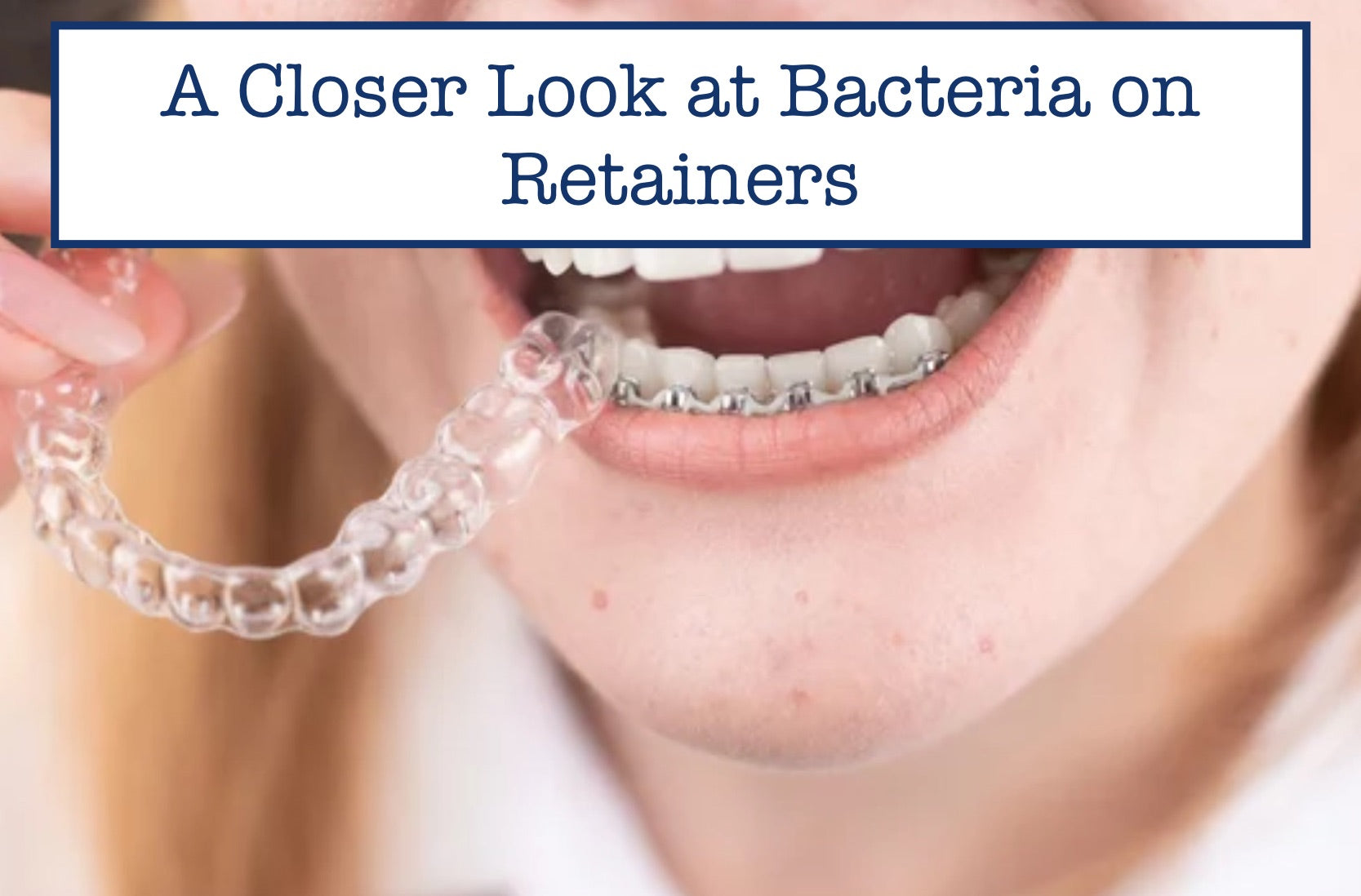 A Closer Look at Bacteria on Retainers – B.WEISS Health