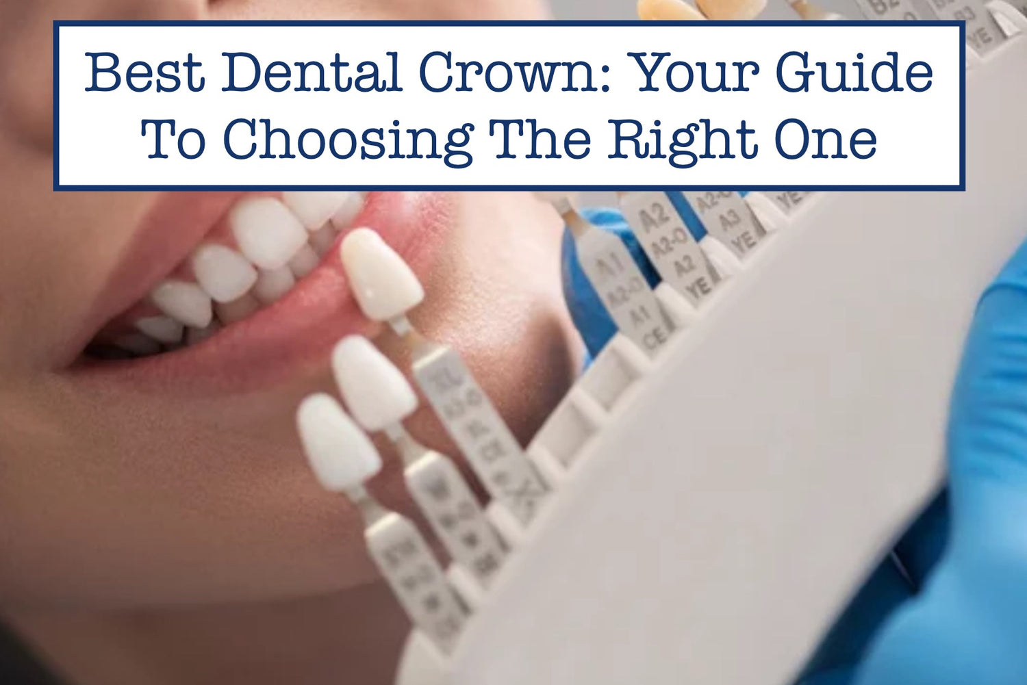 Best Dental Crown: Your Guide To Choosing The Right One – B.WEISS Health