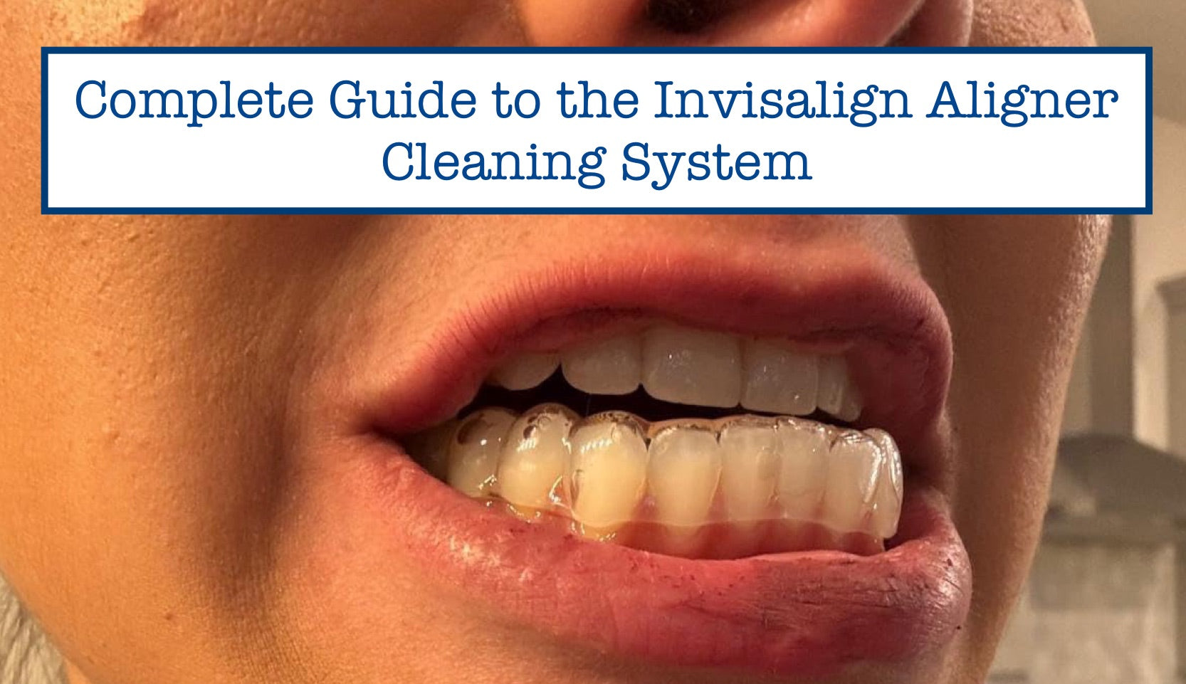Complete Guide to the Invisalign Aligner Cleaning System – B.WEISS Health