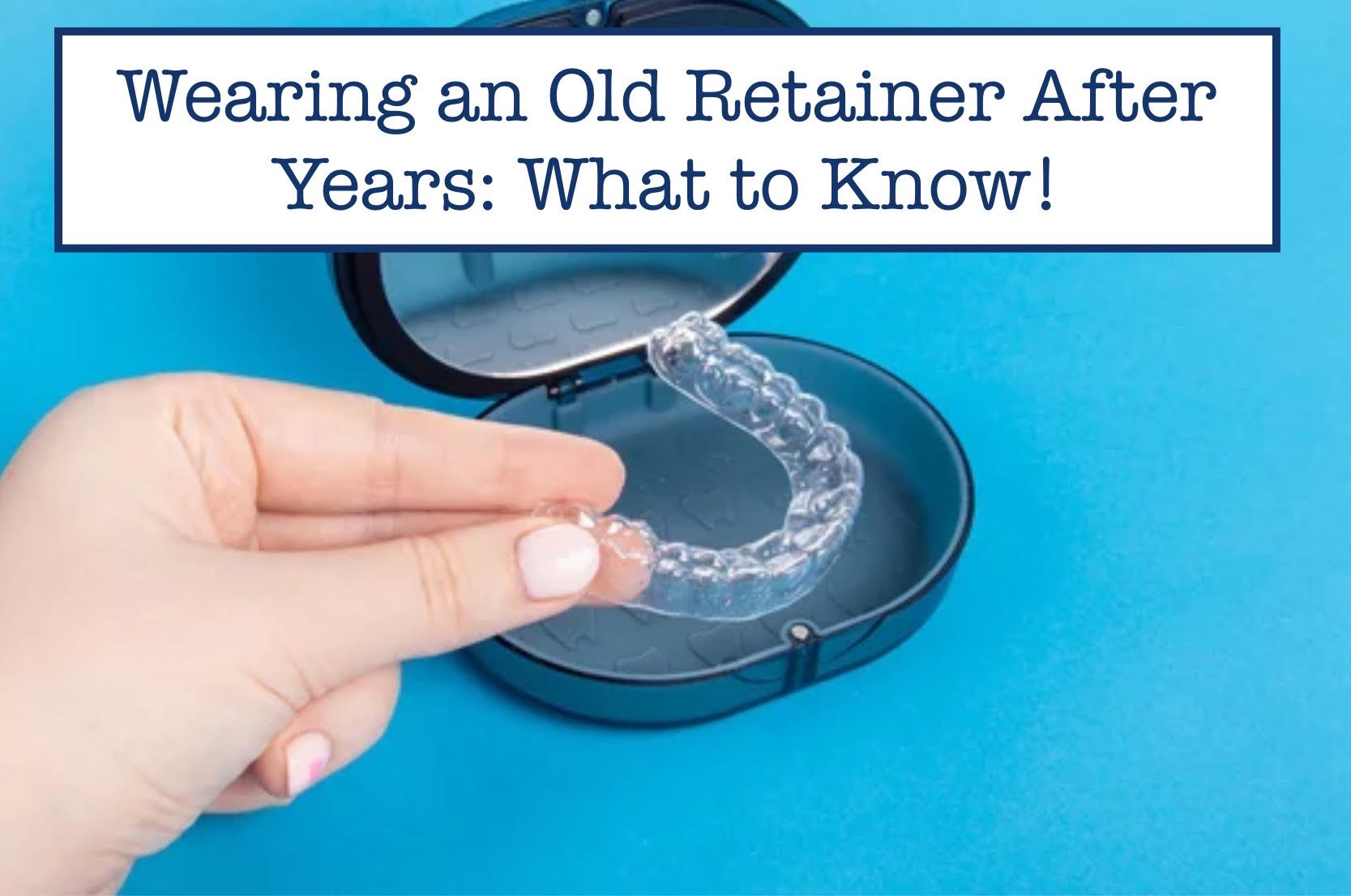 Wearing an Old Retainer After Years: What to Know! – B.WEISS Health