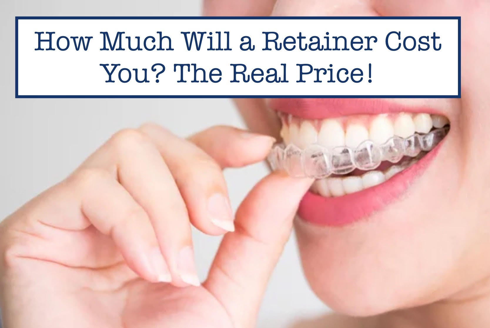 Retainer price store