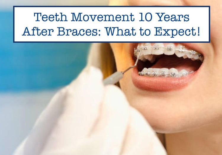 Teeth Movement 10 Years After Braces: What to Expect! – B.WEISS Health