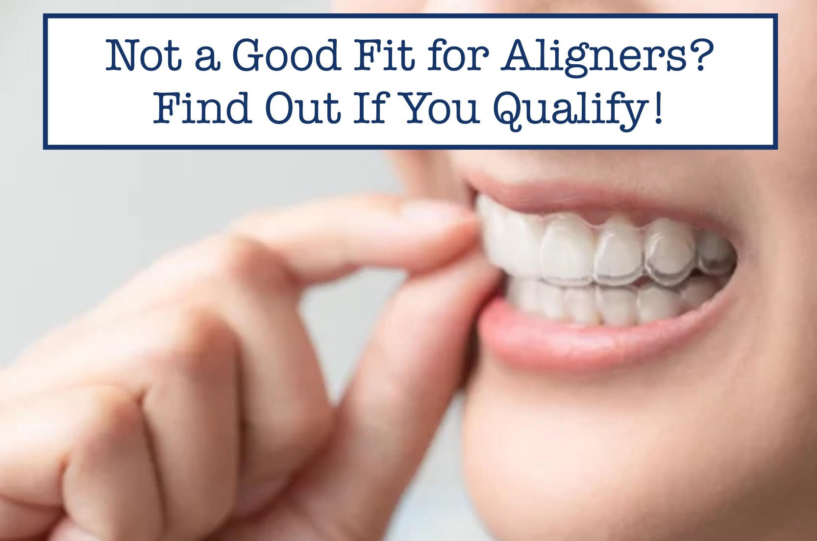 Not a Good Fit for Aligners? Find Out If You Qualify! – B.WEISS Health