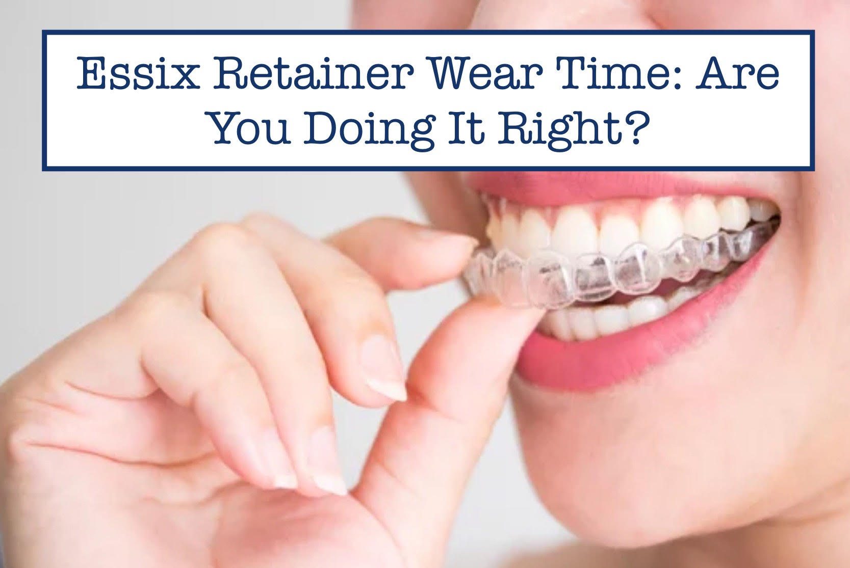 Essix Retainer Wear Time: Are You Doing It Right? – B.WEISS Health
