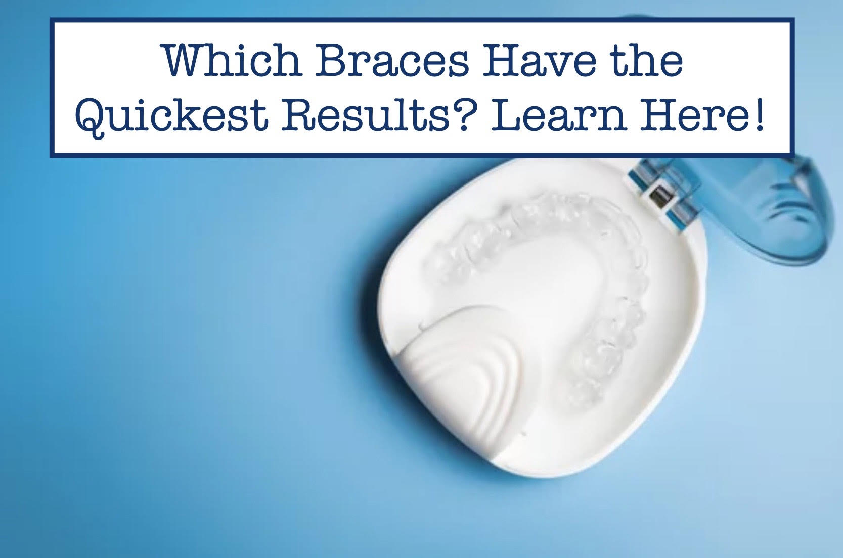 Which Braces Have the Quickest Results? Learn Here! – B.WEISS Health