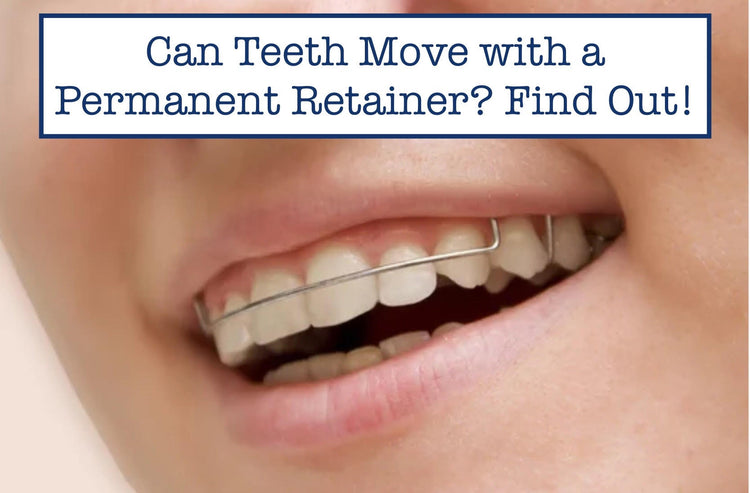 Can Teeth Move with a Permanent Retainer? Find Out! – B.WEISS Health