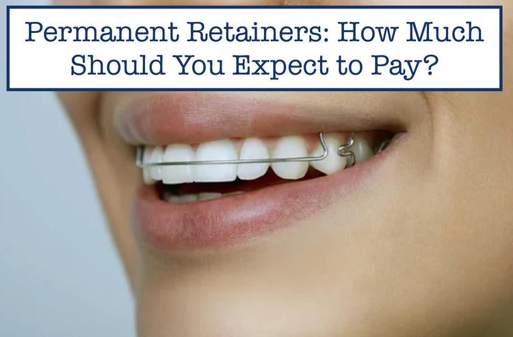 Permanent Retainers: How Much Should You Expect to Pay? – B.WEISS Health