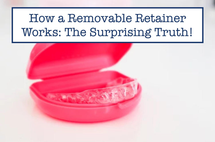 How a Removable Retainer Works: The Surprising Truth! – B.WEISS Health