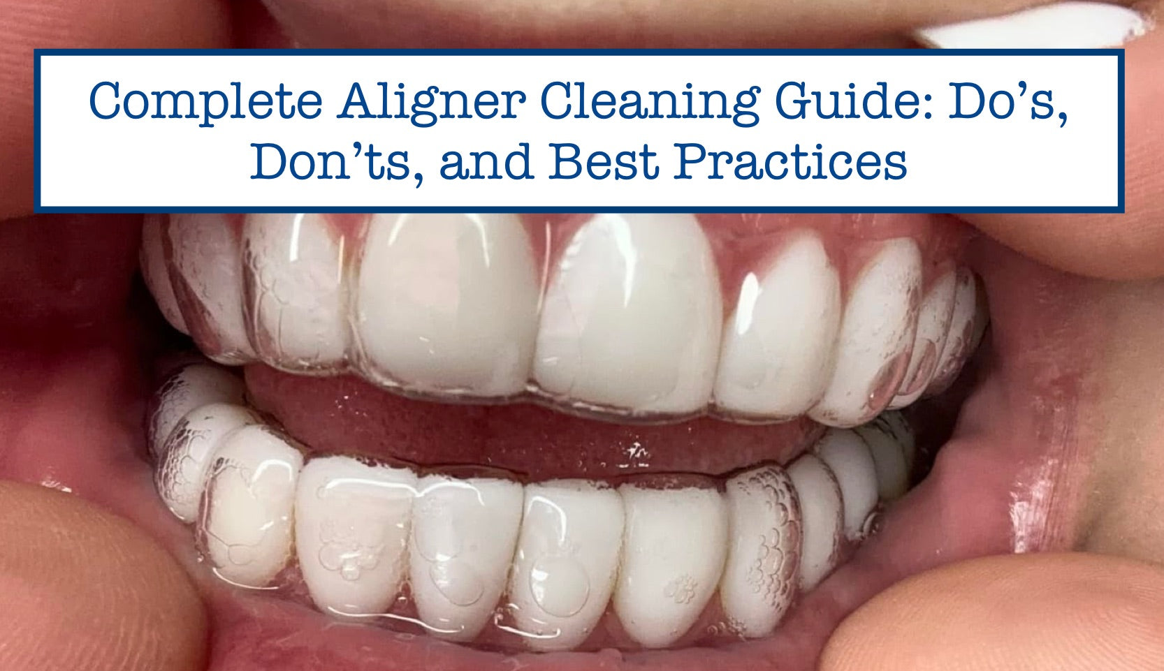 Complete Aligner Cleaning Guide: Do’s, Don’ts, and Best Practices – B ...