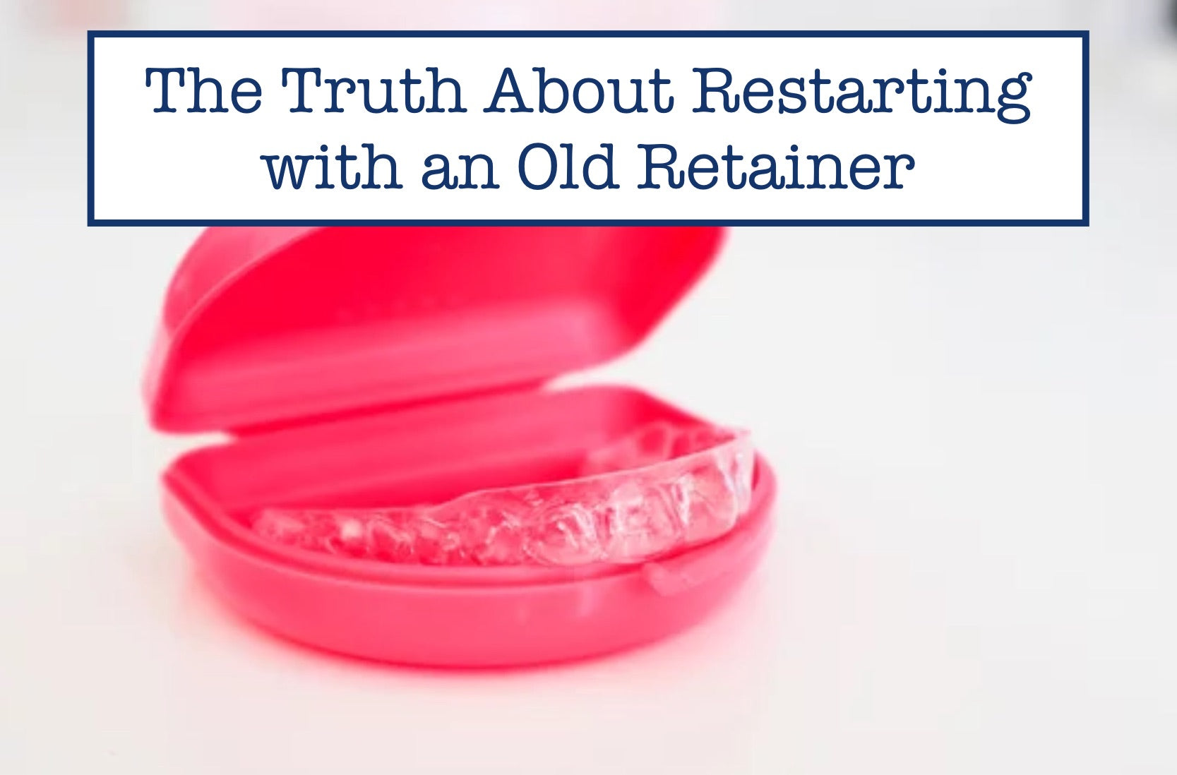 The Truth About Restarting with an Old Retainer – B.WEISS Health