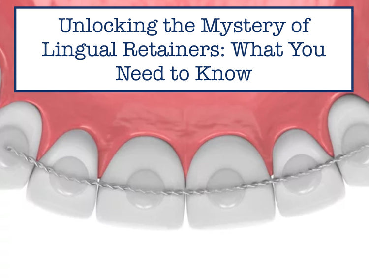Unlocking the Mystery of Lingual Retainers: What You Need to Know – B ...