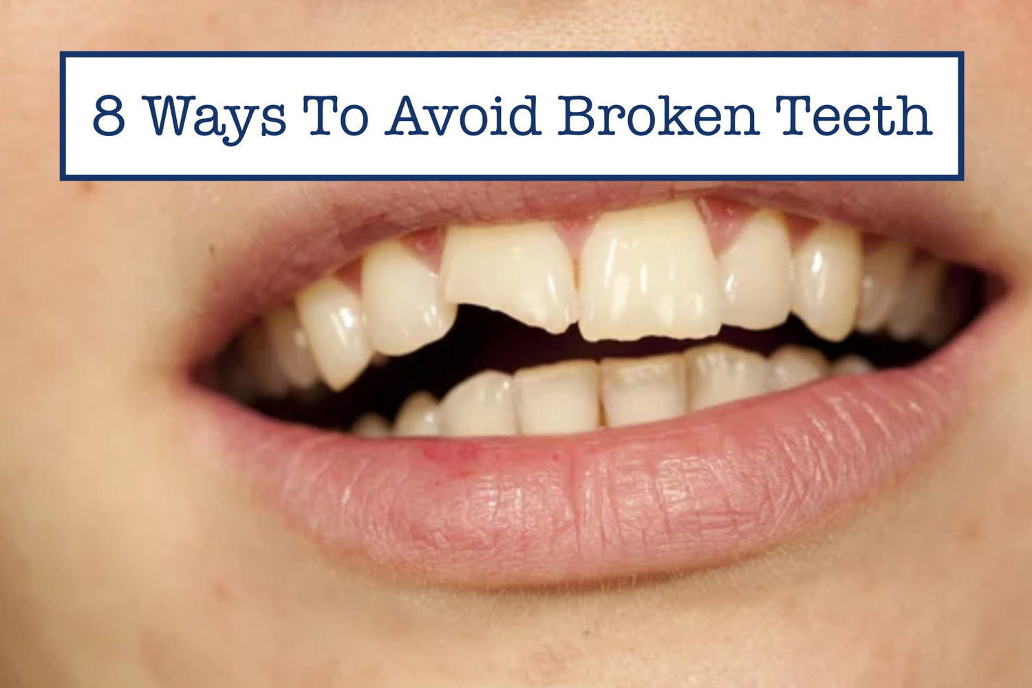 8 Ways To Avoid Broken Teeth – B.WEISS Health