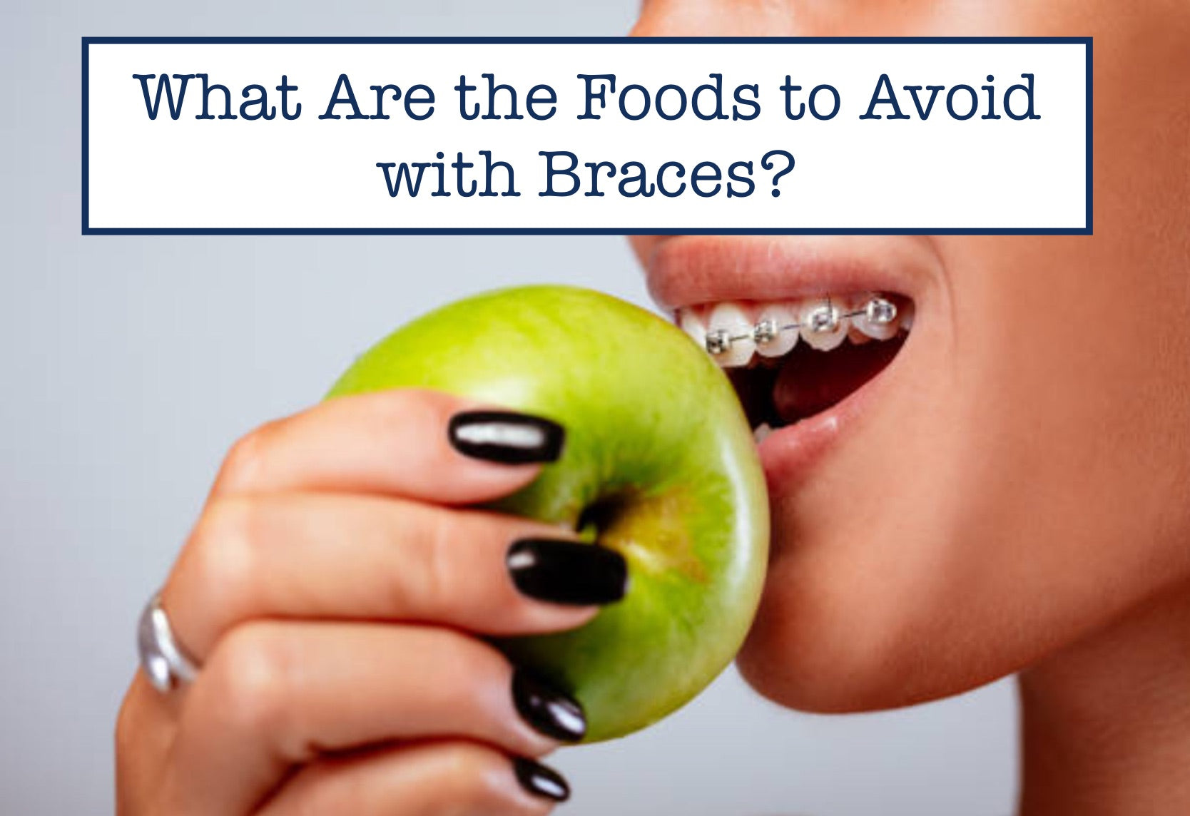 What Are the Foods to Avoid With Braces – B.WEISS Health