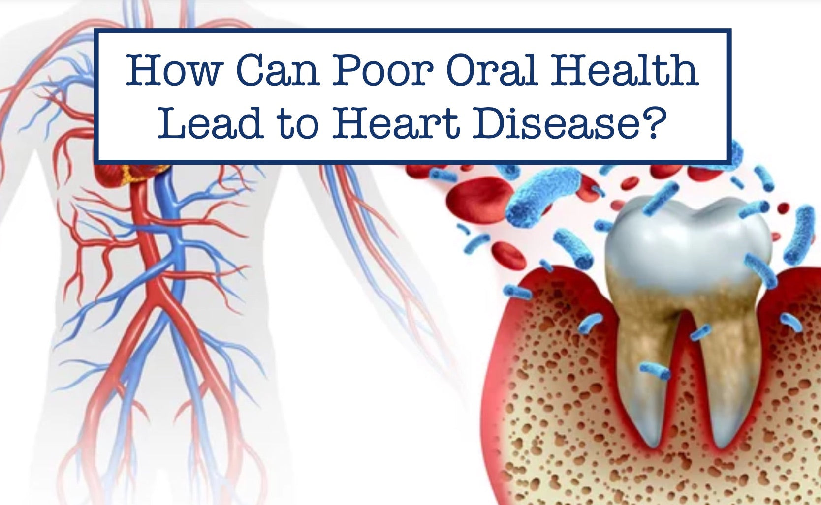How Can Poor Oral Health Lead to Heart Disease – B.WEISS Health