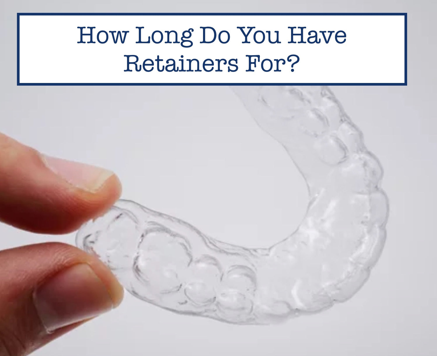 How Long Do You Have Retainers For? – B.WEISS Health