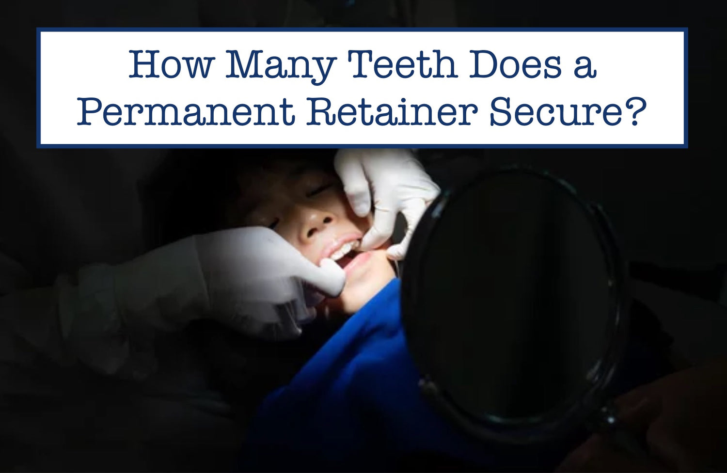 How Many Teeth Does a Permanent Retainer Secure? – B.WEISS Health