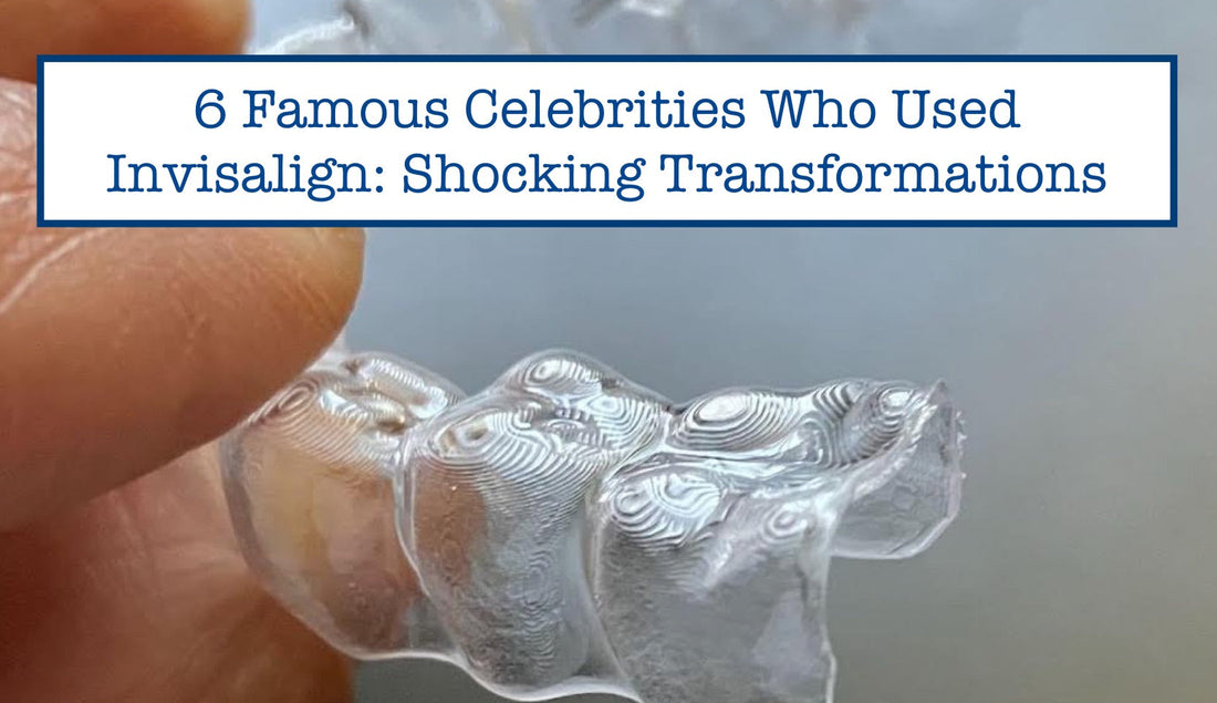 6 Famous Celebrities Who Used Invisalign: Shocking Transformations – B ...