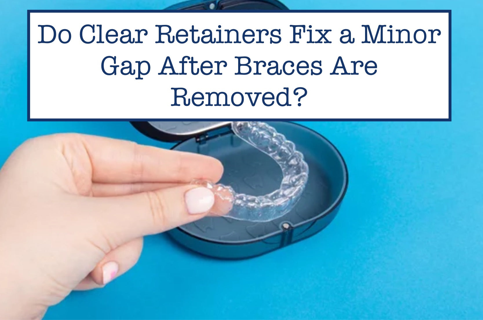 Do Clear Retainers Fix a Minor Gap After Braces Are Removed? – B.WEISS ...