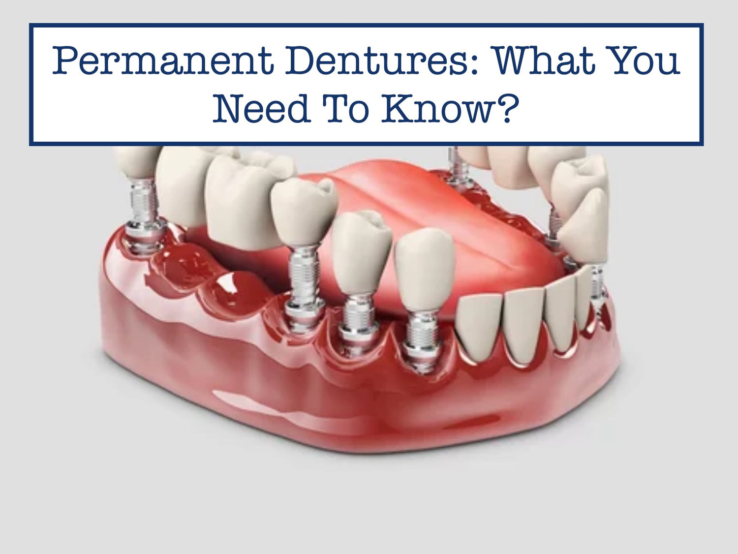 Permanent Dentures: What You Need To Know – B.WEISS Health
