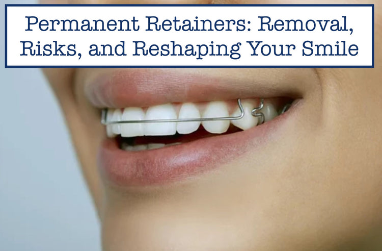 Permanent Retainers: Pros, Cons, and Your Smile’s Future – B.WEISS Health