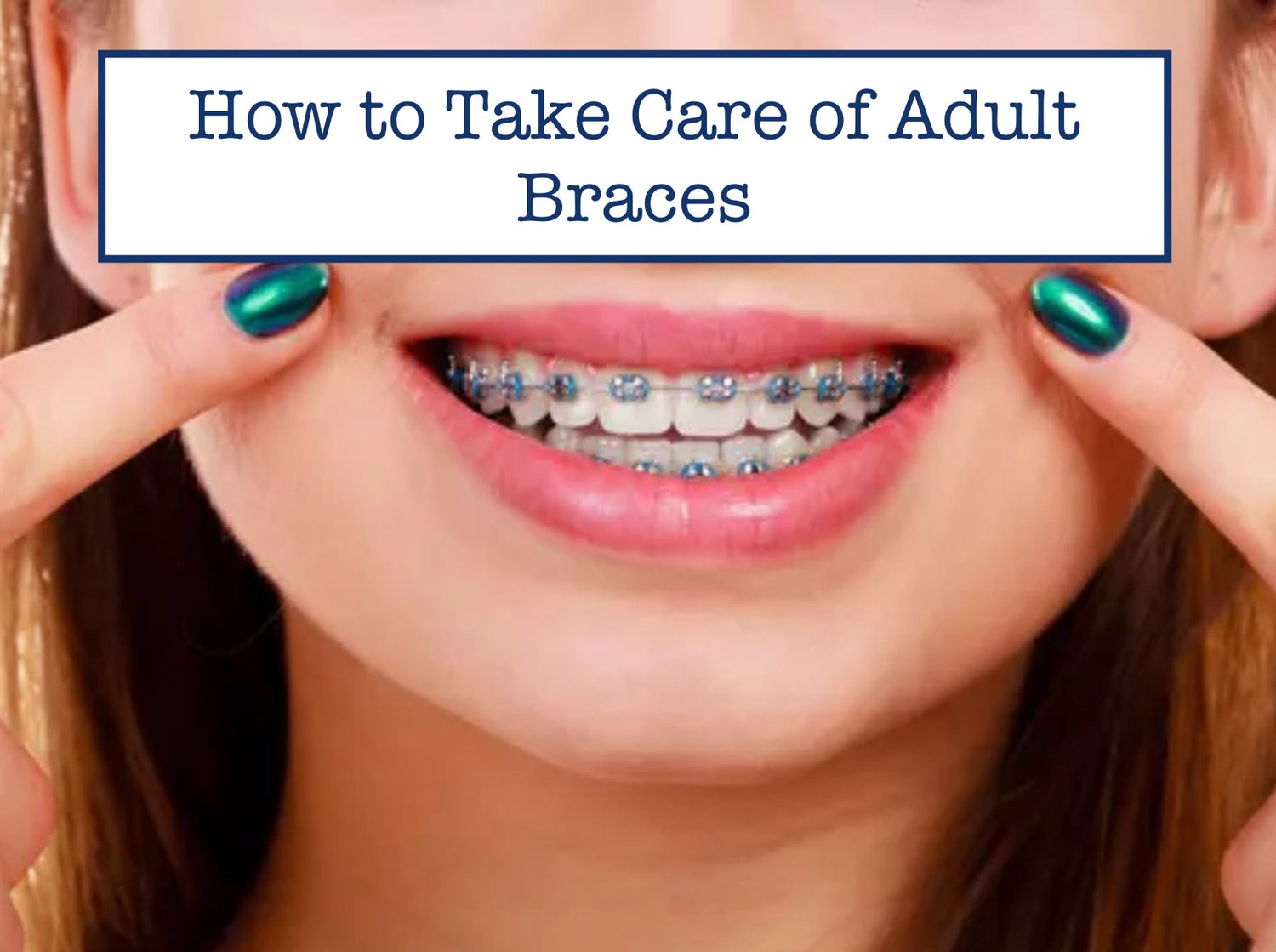 How to Take Care of Adult Braces – B.WEISS Health