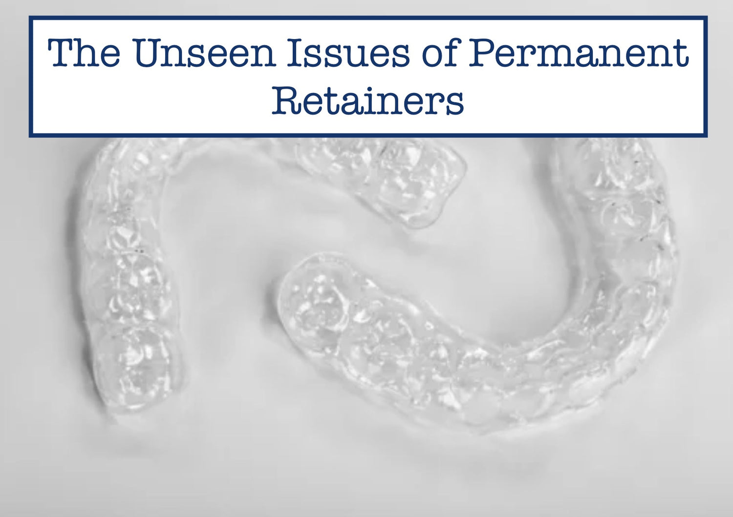 The Unseen Issues of Permanent Retainers – B.WEISS Health