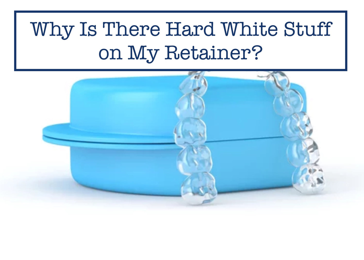 Hard White Stuff on Your Retainer? Here’s What To Do – B.WEISS Water ...