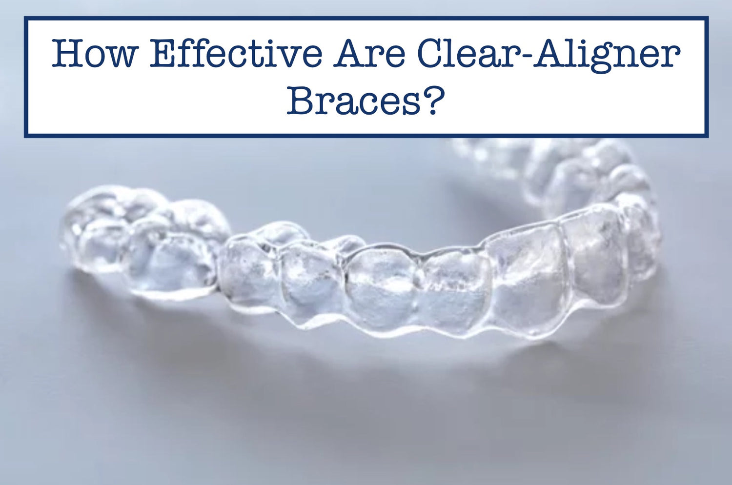 How Effective Are Clear-Aligner Braces? – B.WEISS Health
