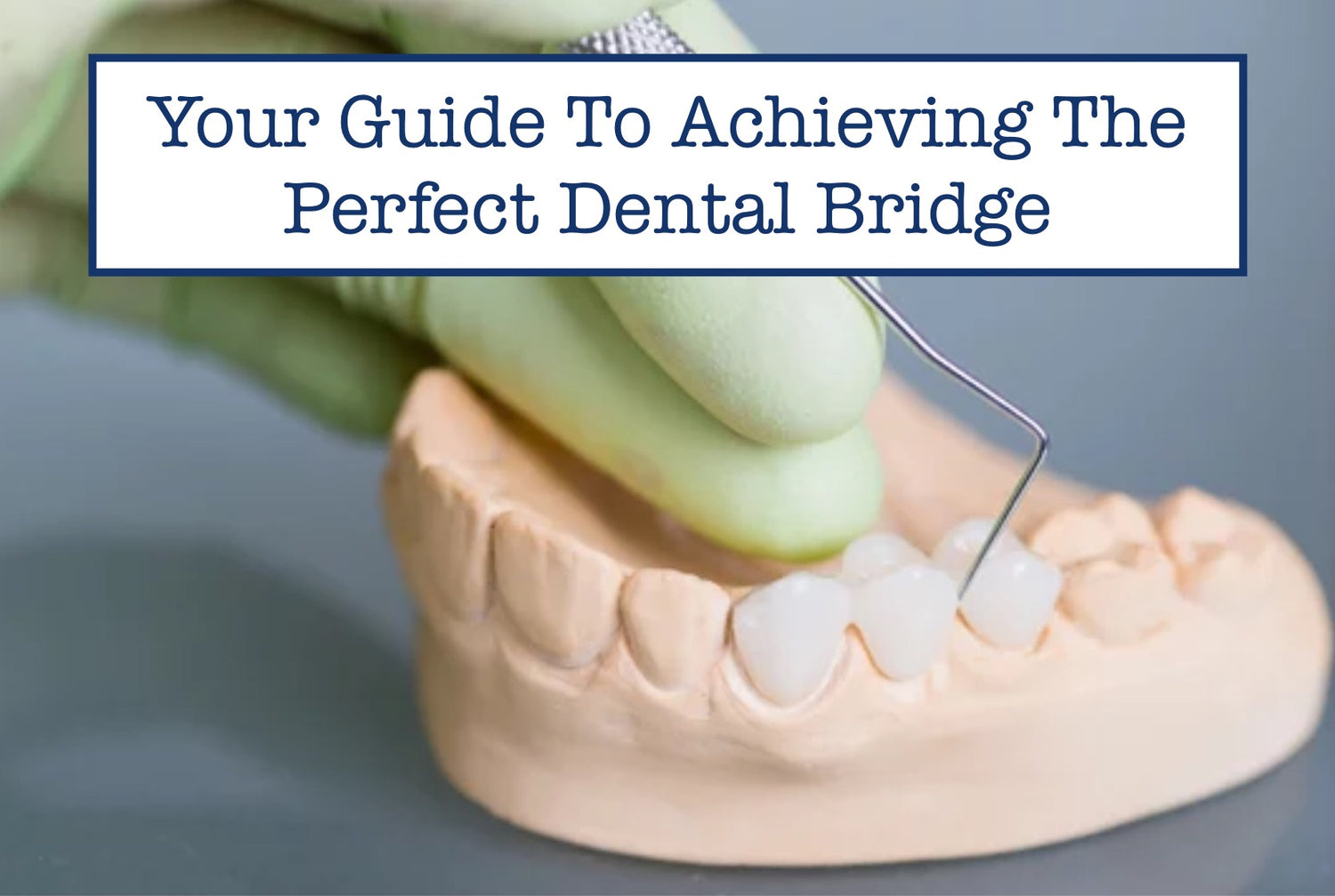 Your Guide To Achieving The Perfect Dental Bridge – B.WEISS Health