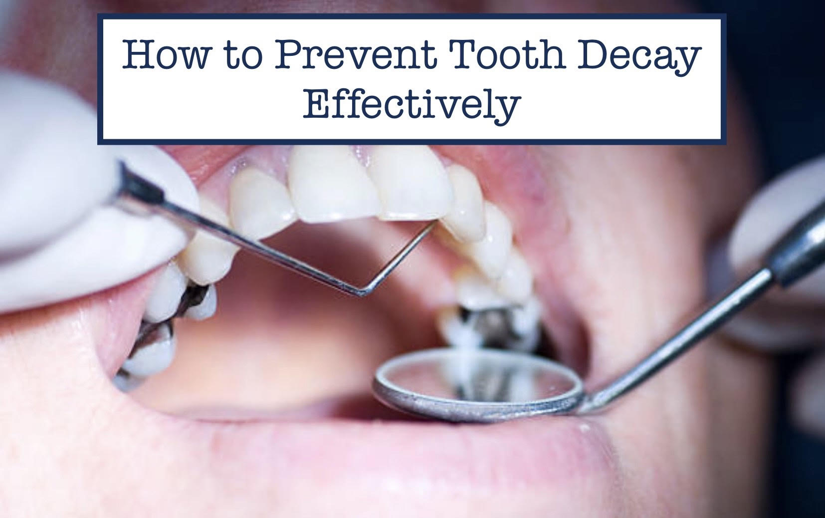 How to Prevent Tooth Decay Effectively – B.WEISS Health